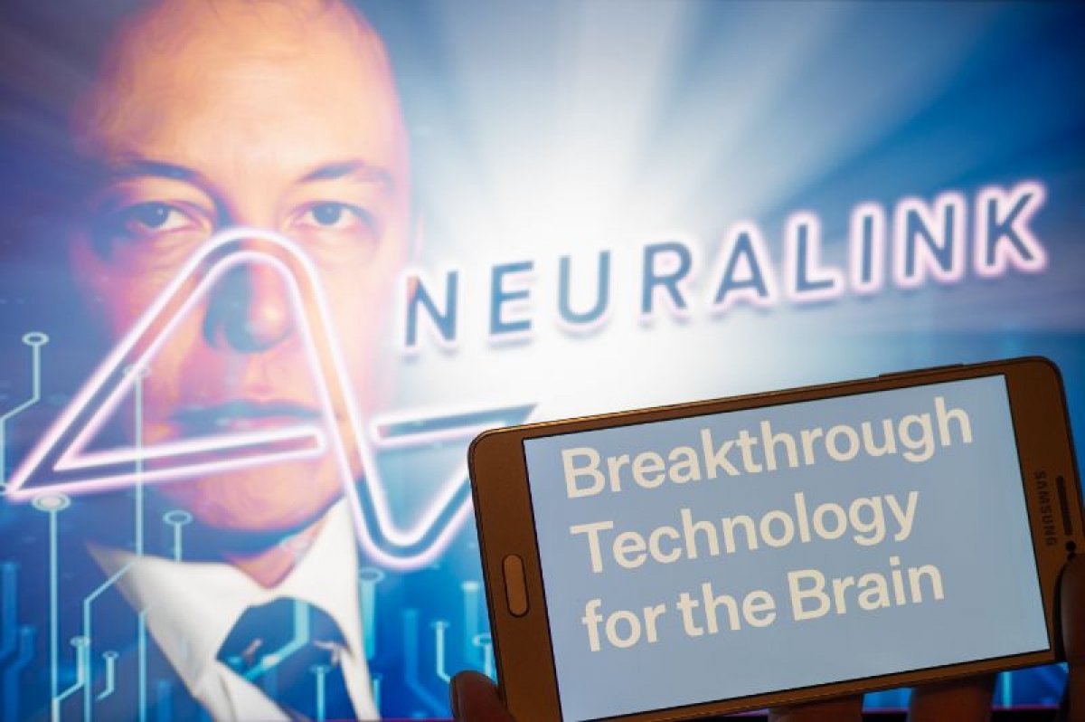 Công Ty Cấy Ghép Não Của Elon Musk Neuralink Bắt đầu Thử Nghiệm Trên